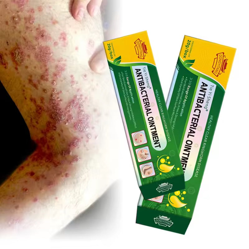 Pommade Antibactérienne - Eczéma – NEOMARKET